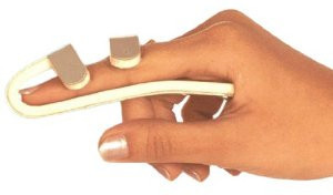 VISSCO Splint Universal or Frog Splints - Buy VISSCO Splint Universal ...