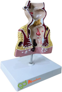 GD ANATOMICALS Human Body Anatomy Rectum Model with Common Pathologies ...