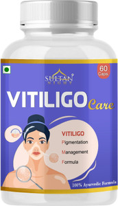 sultan night Vitiligo Care Capsule For Pigmentation Management Formula ...