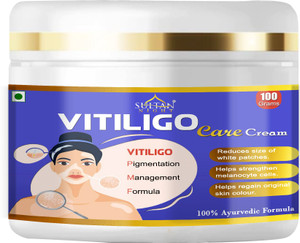 sultan night Vitiligo Care Cream For Pigmentation Management Formula ...