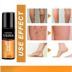 ERVY Varicose veins spray swelling comfort with vericose vein spray ...