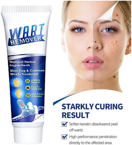 MYEONG Massa Remover Cream All Type Skin Warts Remover Cream Price in ...