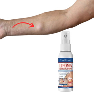 SWELLEDON Lipoma Herbal Spray for excess fat on any part of the body ...