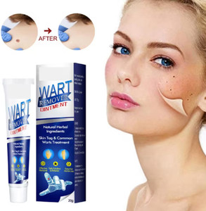 Elecsera Wart Remover Cream, Massa Removal Cream Pack of 1 of 100G ...