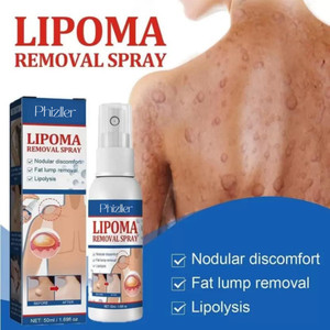 PHIZLLER Lipoma Removal Herbal Spray Lump Remover for Neck, Shoulder ...