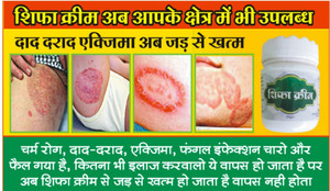 SANJEEVANI AUSHDHIY Cream Charm Rog Price in India - Buy SANJEEVANI ...