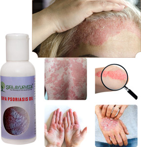 Sifa Ayurveda Psoriasis Ayurveda Oil | Psoriasis,Eczema Dry Patches ...