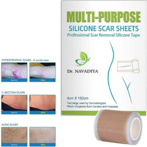 Dr. NAvadiya Silicone Scar Removal Sheet Tape For C-Section, Keloid ...