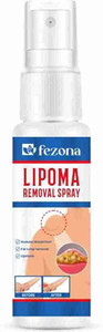 FEZONA Herbal Lipoma Remover Spray Painless Herbal Lipolysis Fat Relief ...