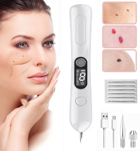 Prague Skin Mole Removal Laser Pen for Freckle, Wart, Tattoo & Dark ...