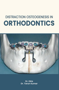 DISTRACTION OSTEOGENESIS IN ORTHODONTICS: Buy DISTRACTION OSTEOGENESIS ...