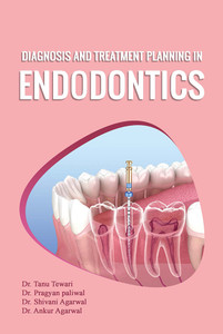 Diagnosis and Treatment Planning In Endodontics: Buy Diagnosis and ...