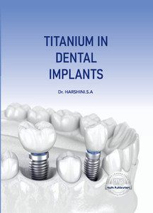 Titanium in Dental Implants: Buy Titanium in Dental Implants by Dr ...