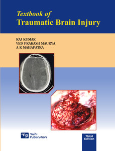 Textbook of Traumatic Brain Injury: Buy Textbook of Traumatic Brain ...
