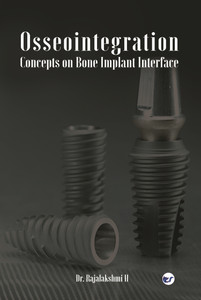Osseointegration - Concepts on Bone Implant Interface: Buy ...