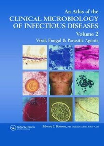 Atlas of the Clinical Microbiology of Infectious Diseases: Buy Atlas of ...