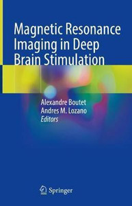 Magnetic Resonance Imaging in Deep Brain Stimulation: Buy Magnetic ...