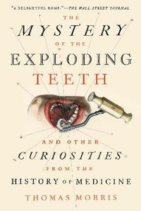 The Mystery of the Exploding Teeth: Buy The Mystery of the Exploding ...