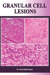 Granular Cell Lesions: Buy Granular Cell Lesions by Dr. JINTU ...