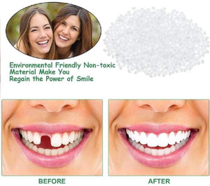 SRK 20ml Temporary Tooth Tooth Filling Temp Replace Missing Denture ...