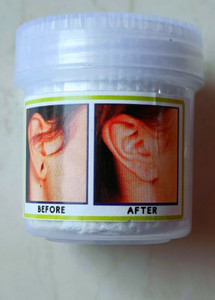 GreenStudio Reusable Ear Lobe Support Price in India - Buy GreenStudio ...