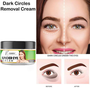 Ember Under Eye Cream, Dark Circle Remover Cream - Minimizes Darkened ...