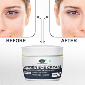 Sabates Pure Radiance Under Eye Cream for Wrinkles, Puffy Eyes & Dark ...