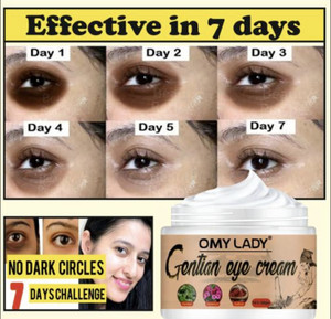 Omy Lady Eye Cream for Dark Circle | Dark Circle Remover Cream Price in ...