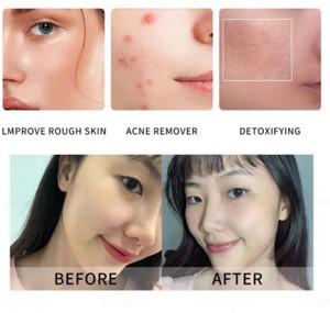 MYEONG AS2541 Face Shaping Mask Price in India - Buy MYEONG AS2541 Face ...