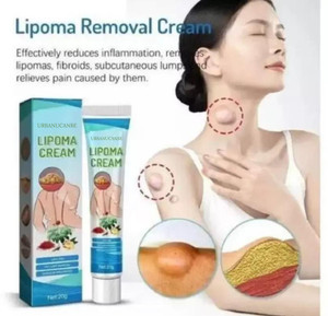 URBANUCANBE Lipoma Removal Cream Lump Remover of Neck Fat, Shoulder Fat ...