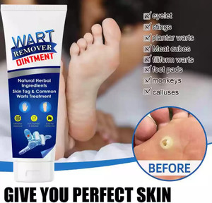 luzimaisa Massa And Wart Skin Removal Ointment Gel - Price in India ...