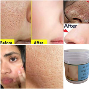 TRZ Bye Bye Open Pores Face Cream Skin Whitening Gel Price in India ...
