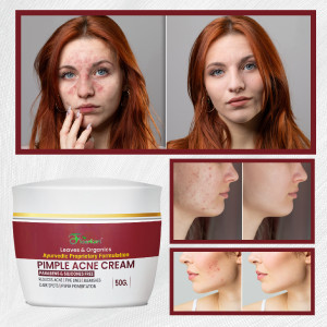 Floarkart Pimple Cream | Blemish & Acne Removal | A Painless Treatment ...