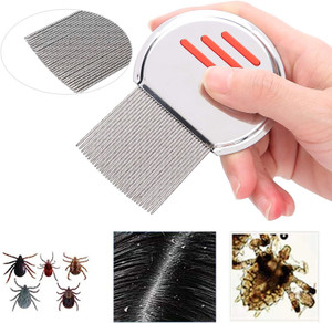 SAIM Lice Comb For Women And Kids Stainless Steel Lice Terminator Fine ...