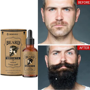 Rosevely Men Beard Growth & Very Shiny And Thick Oil with a good aroma ...