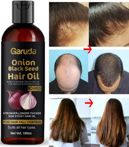 Garuda Onion Hair Oil- Non Sticky hair oil for 2X Faster Hair Growth ...