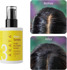 ARATA Grow+ Turmeric Scalp Serum|Boosts Hair Growth|With Capilia Longa ...