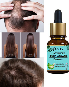 AGLEY Advanced Hair Growth Serum, Hair Serum| For Dry & Frizzy Hair ...