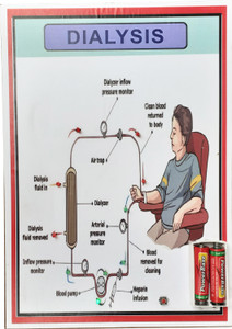 MELODY's MODEL OF DIALYSIS Working Science Model For School Project ...