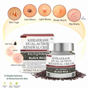 Ridoy KeraErase dual action renewal cream | Next-Gen Skin Renewal ...