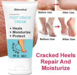 Naturalleaf feet Smooth Foot Crack Cracked Heel Repair Foot Cream ...