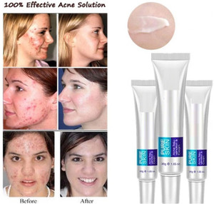 MYEONG Face care Anti Acne Treatment Cream - Price in India, Buy MYEONG ...