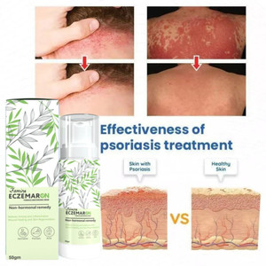 NDT Herbal Eczemaron Cream Pack Of 1.7 - Price in India, Buy NDT Herbal ...