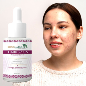 7days natural Dark Spot Remover Serum, Blemish Removal,Acne Scar Anti ...