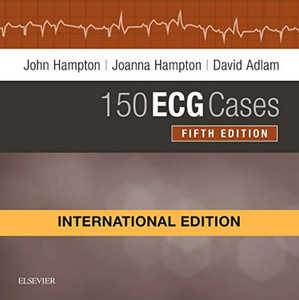 150 ECG Cases, International Edition: Buy 150 ECG Cases, International ...