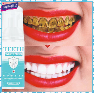 Qwera Dream White -Fresh Mint Instant Teeth Whitening Foam Mouthwash ...