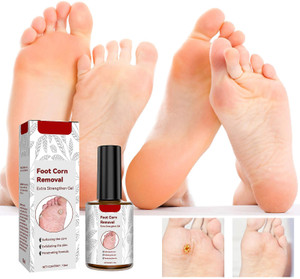 RAPIK 100%ORIGINAL Foot Corn Removal Gel, Foot Corn Treatment Price in ...