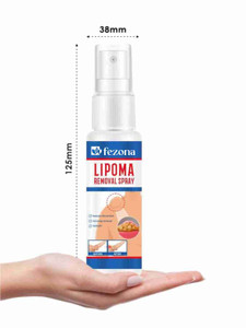 FEZONA Herbal Lipoma Remover Spray Painless Herbal Lipolysis Fat Relief ...