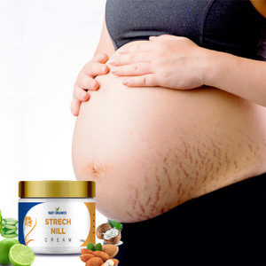 Vadit organics Stretch Marks Scar removal Cream oil in during after ...