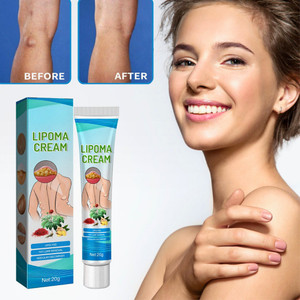 SIYDHA Lipoma Care Cream Fatty Lump On Leg Herbal Lipoma Removal Cream ...